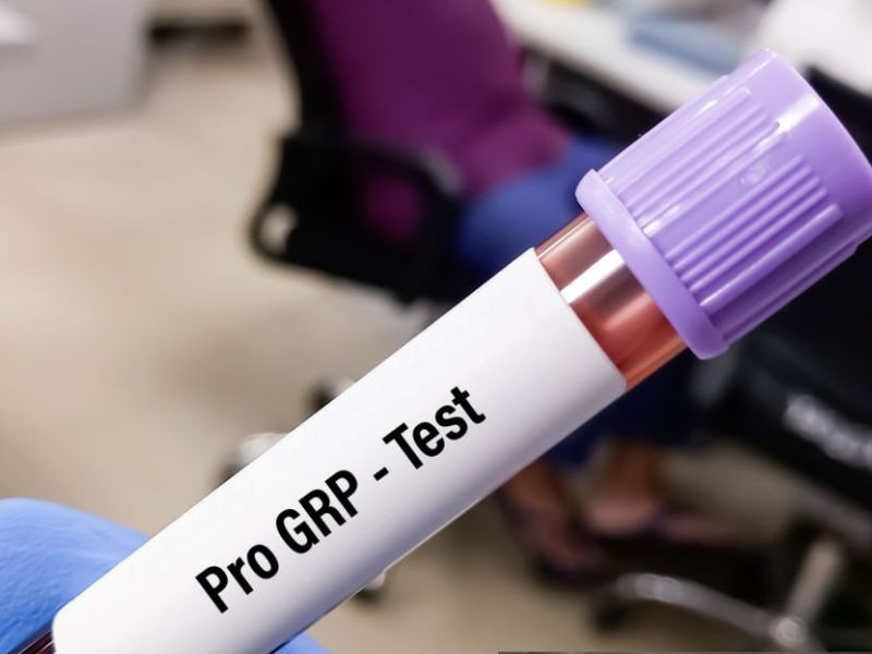 Vai trò của Pro-GRP trong chẩn đoán ung thư phổi tế bào nhỏ